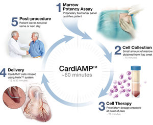 BioCardia shares early data from phase III CardiAMP cell therapy trial ...