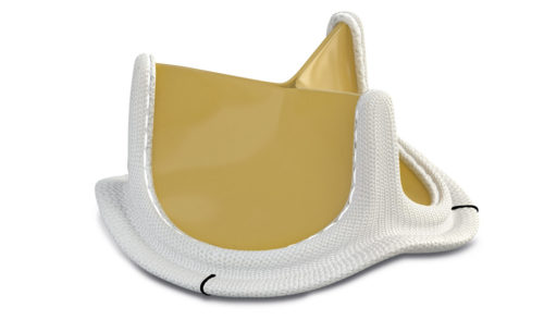 First procedures using Edward Lifesciences’ Inspiris Resilia aortic ...