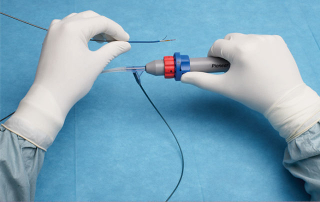 Pioneer Plus catheter re-entry device with intravascular ultrasound ...