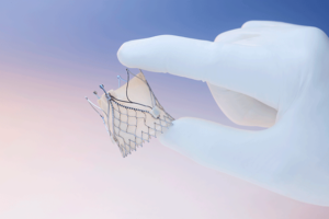 Study of next-generation JenaValve device completes enrolment - CN