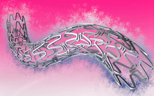 Data confirms long-term safety and efficacy of Angiolite drug-eluting stent