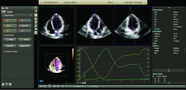 ADVERTORIAL: Rethinking the future of cardiology imaging