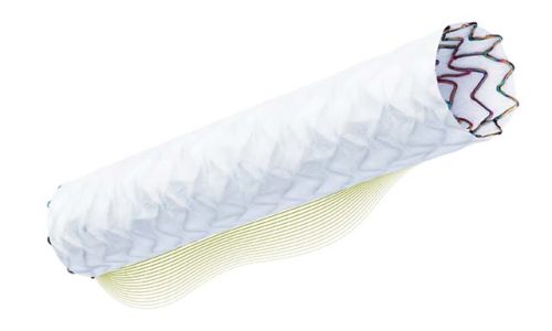 US FDA approves PK Papyrus stent for coronary perforations - CN