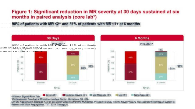 ADVERTORIAL: Edwards PASCAL™ Transcatheter Valve Repair System is ...