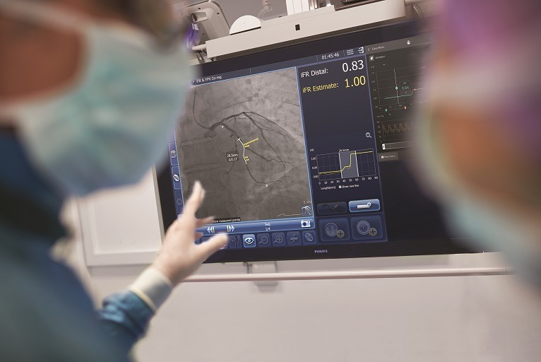 Philips announces study of PCI guided by integrated iFR and X-ray