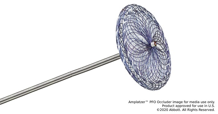 American Academy of Neurology recommends PFO closure for selected ...