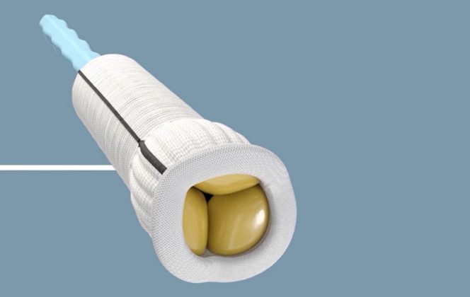 Edwards’ Konect Resilia and Mitris Resilia gain Health Canada approval ...