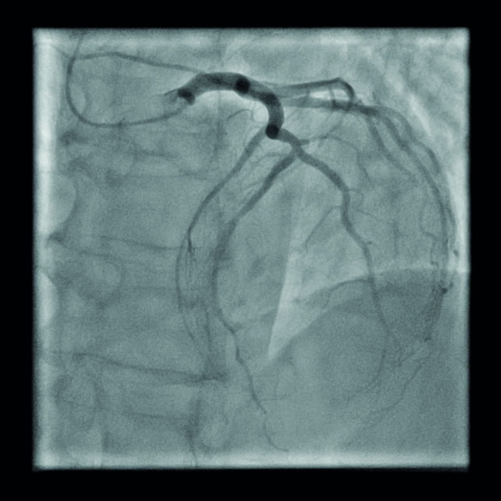 The challenges of the modern cath lab - Cardiovascular News
