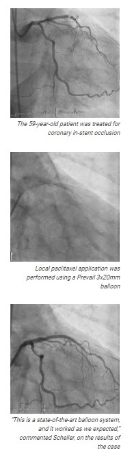 Prevail case - Cardiovascular News
