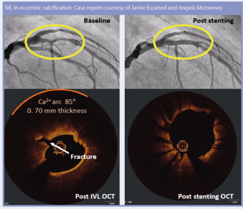 ADVERTORIAL: Fresh data paint a positive picture for IVL in both ...