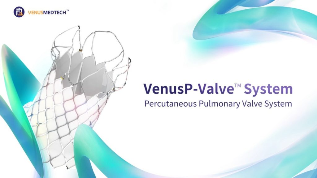 VenusP-Valve gains CE mark