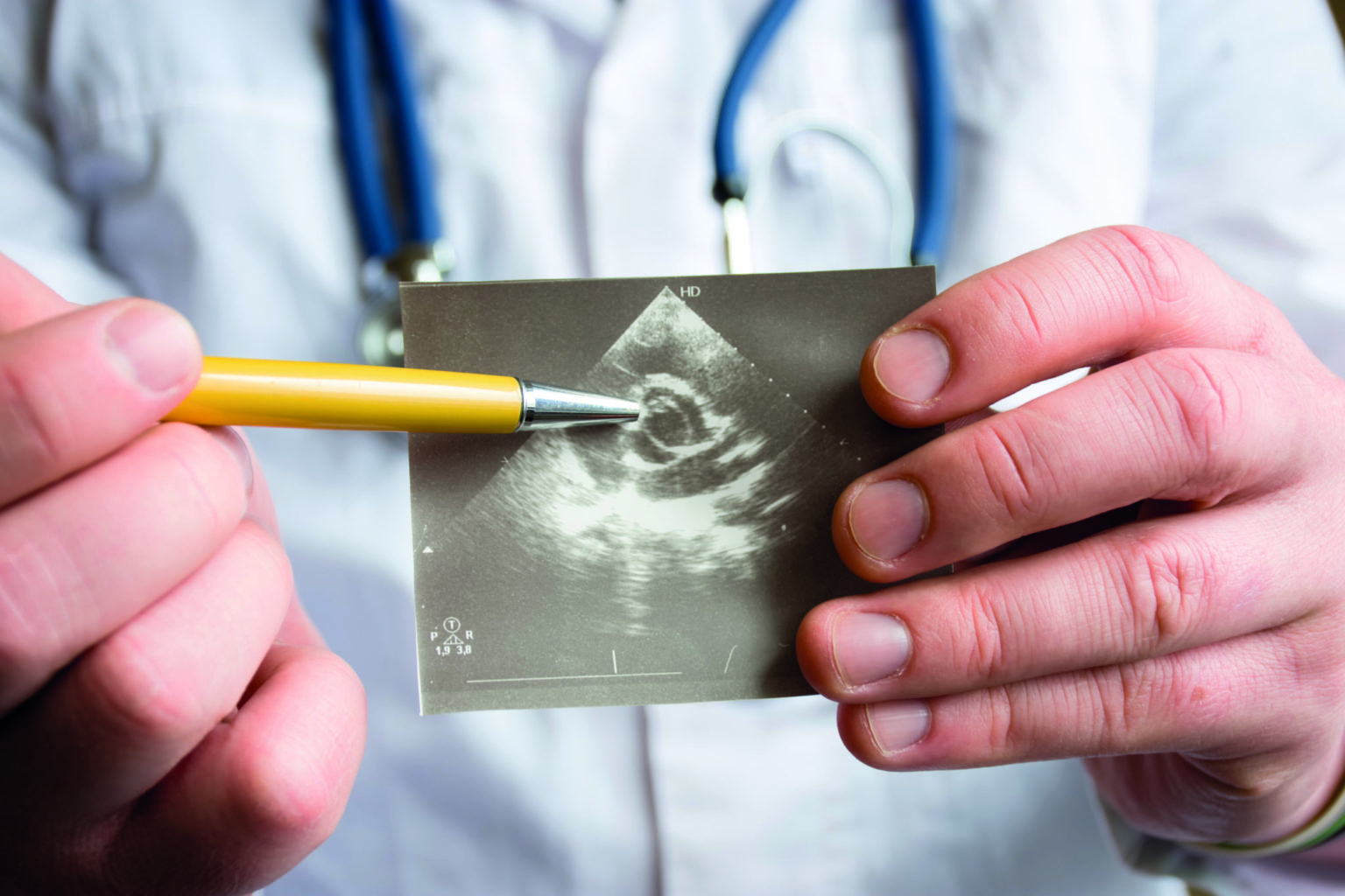 ACC.25: Studies evaluate aortic stenosis referral and detection ...
