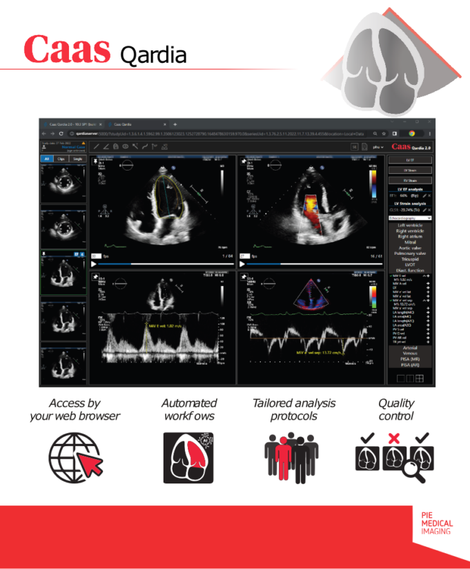 Pie Medical Imaging announces launch of CAAS Qardia 2.0 ...