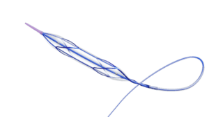 ADVERTORIAL: A step forward in scoring balloon catheter design ...