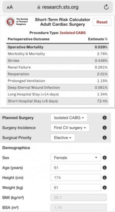 STS risk calculator uses power of big data to predict cardiac surgery risk