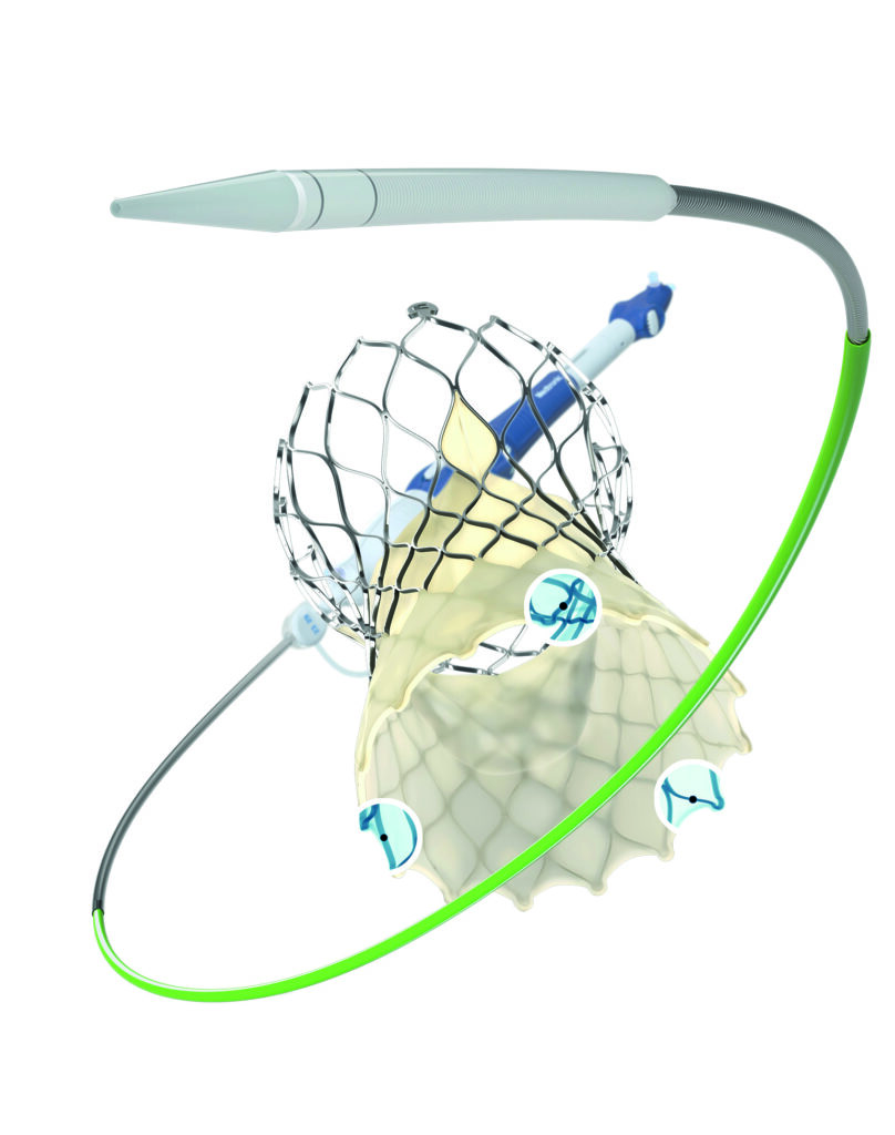 Advertorial: Newest-generation TAVI platforms designed to meet the ...