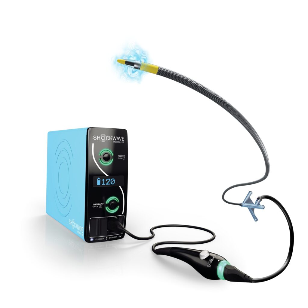 Shockwave commences trial of Javelin IVL catheter in complex coronary ...