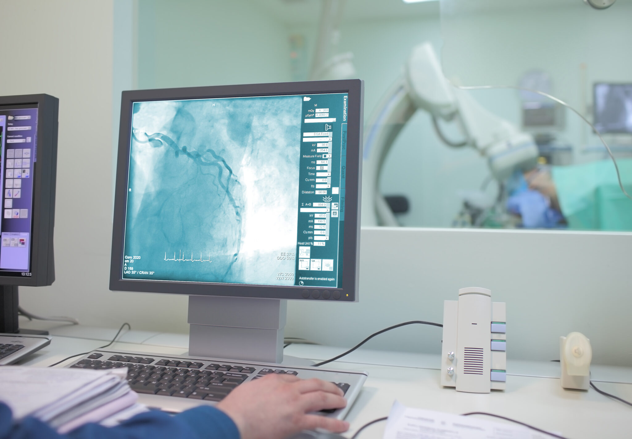 SMARTFLOW study to assess diagnostic accuracy of AI-powered angiography ...