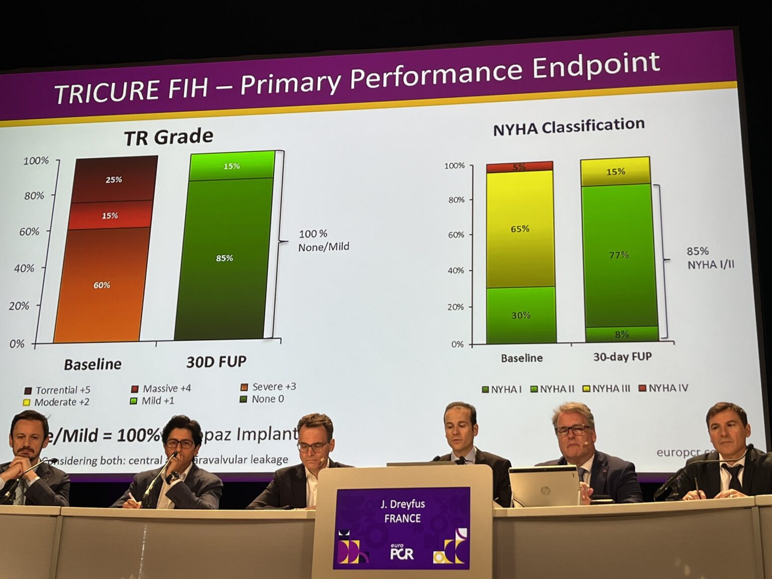 EuroPCR 2025 hears early outcomes of Topaz TTVR system - Cardiovascular ...