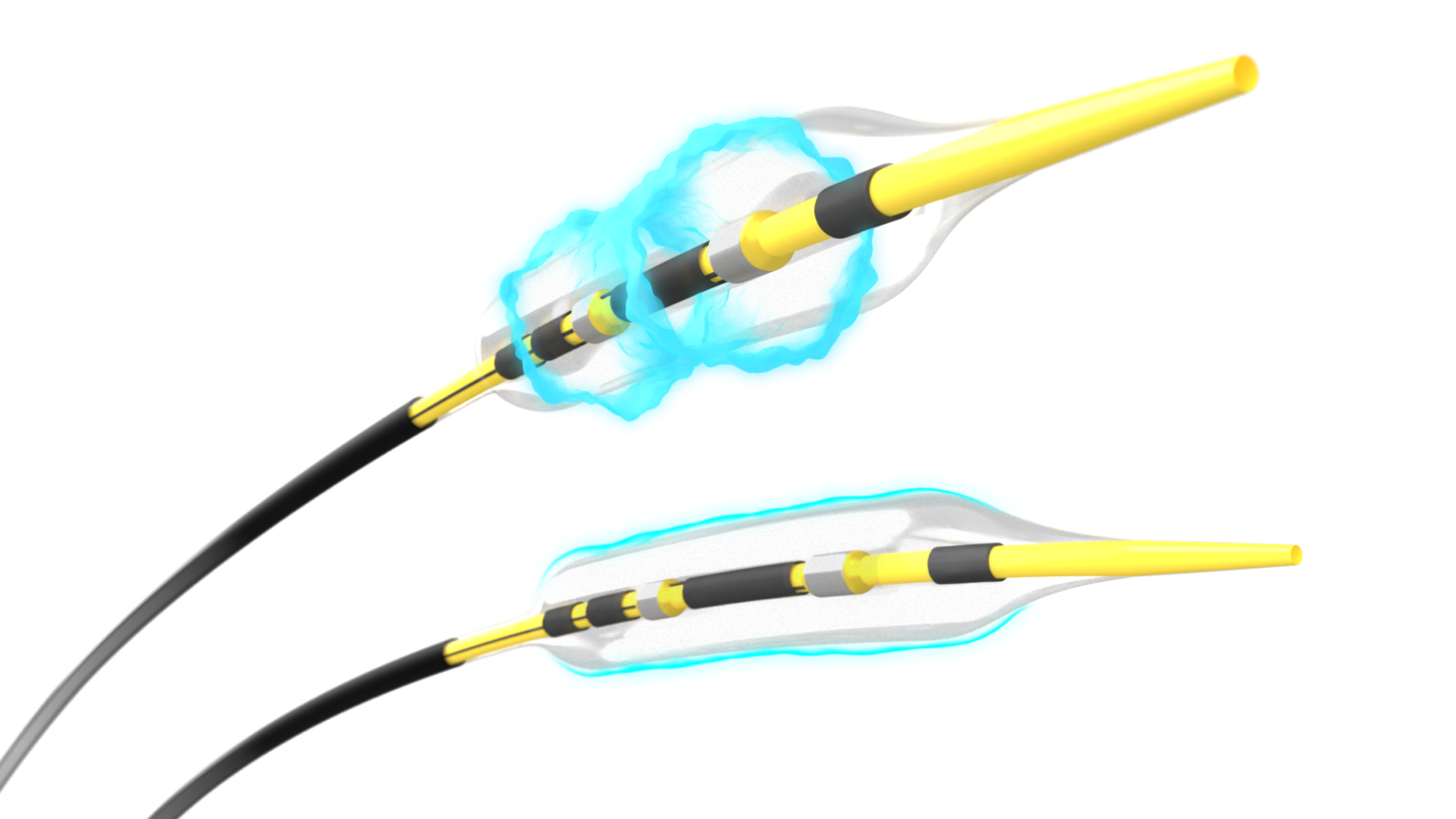 Advertorial: New evidence investigates the impact of Shockwave IVL ...